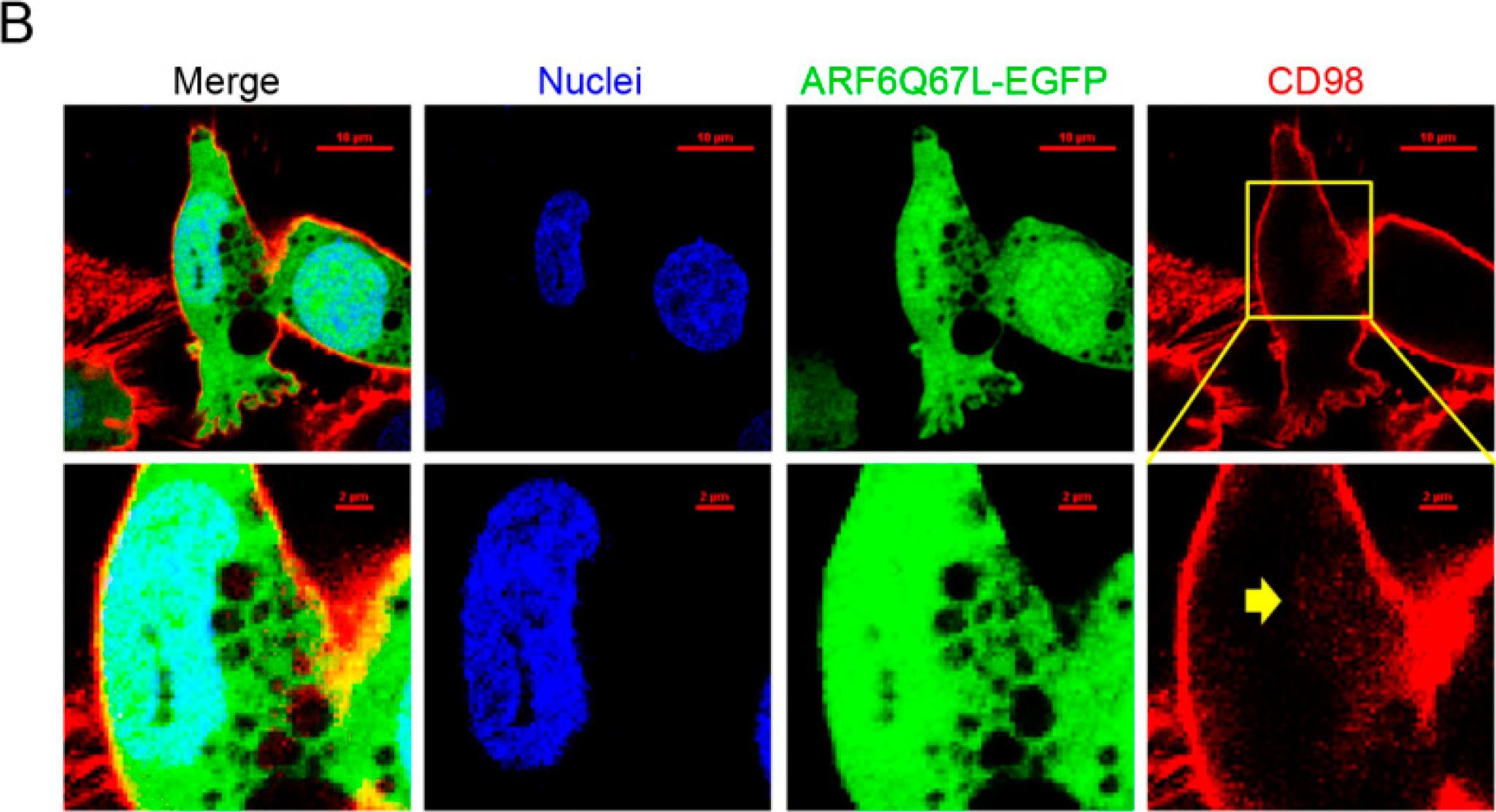 SLC3A2 Fusion Protein Ag7280 | Proteintech | 武汉三鹰生物技术有限公司