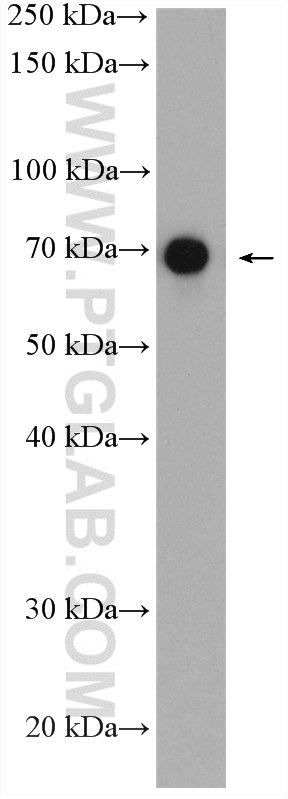 SLC6A8 Fusion Protein Ag14500 | Proteintech | 武汉三鹰生物技术有限公司