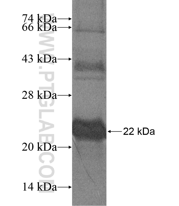 SLCO1B1 Fusion Protein Ag17407 | Proteintech | 武汉三鹰生物技术有限公司