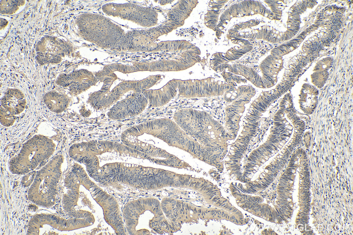 SMAD2 antibody (12570-1-AP) | Proteintech