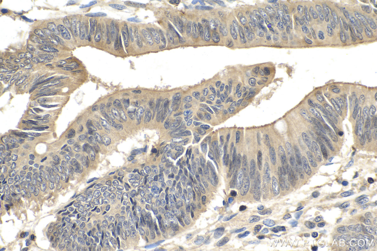 SMAD2 antibody (12570-1-AP) | Proteintech