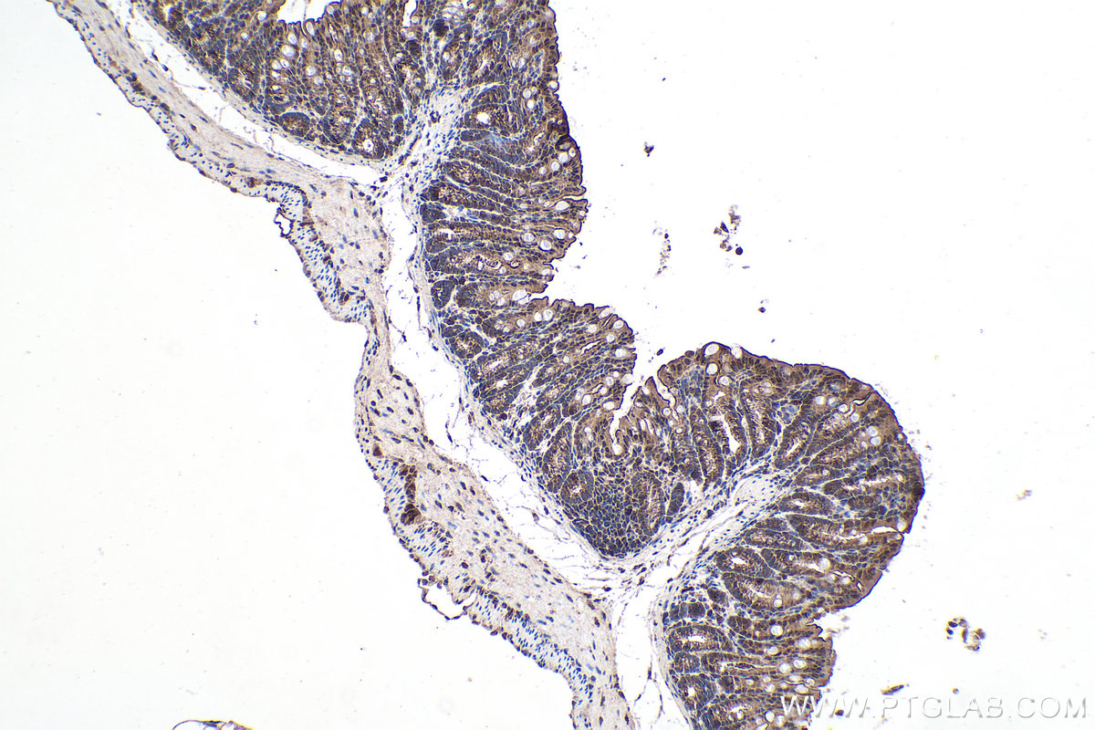 SMAD2 antibody (67343-1-Ig) | Proteintech