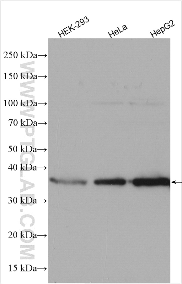 SMN antibody (11708-1-AP) | Proteintech | 武汉三鹰生物技术有限公司 SMN antibody (11708-1-AP) | Proteintech | 武汉三鹰生物技术有限公司