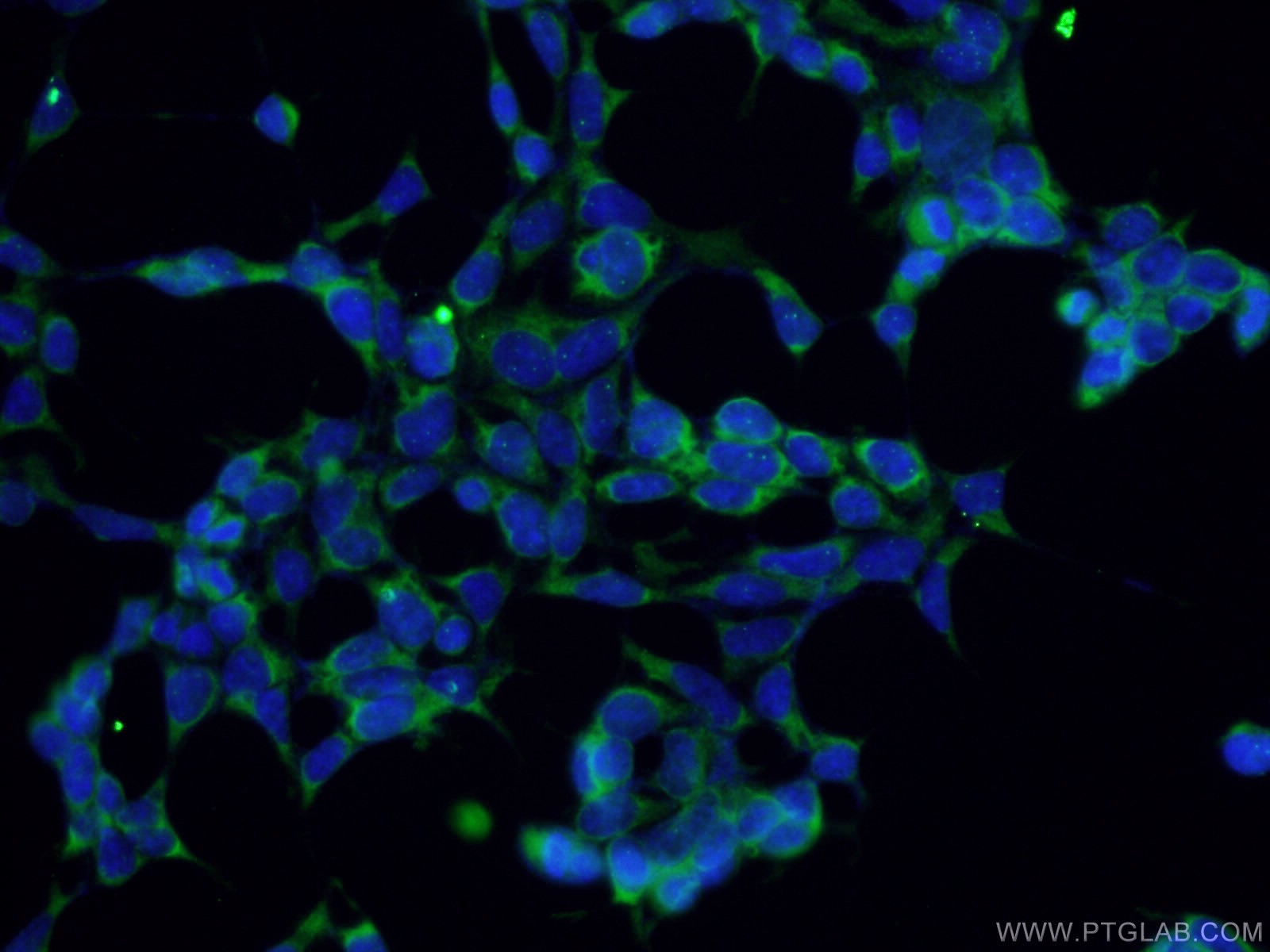 SMN (Human,Mouse,Rat) Antibody 60154-2-Ig | Proteintech
