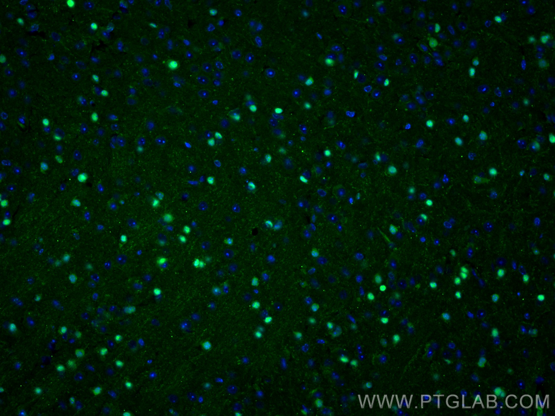SOX10 antibody (66786-1-Ig) | Proteintech | 武汉三鹰生物技术有限公司