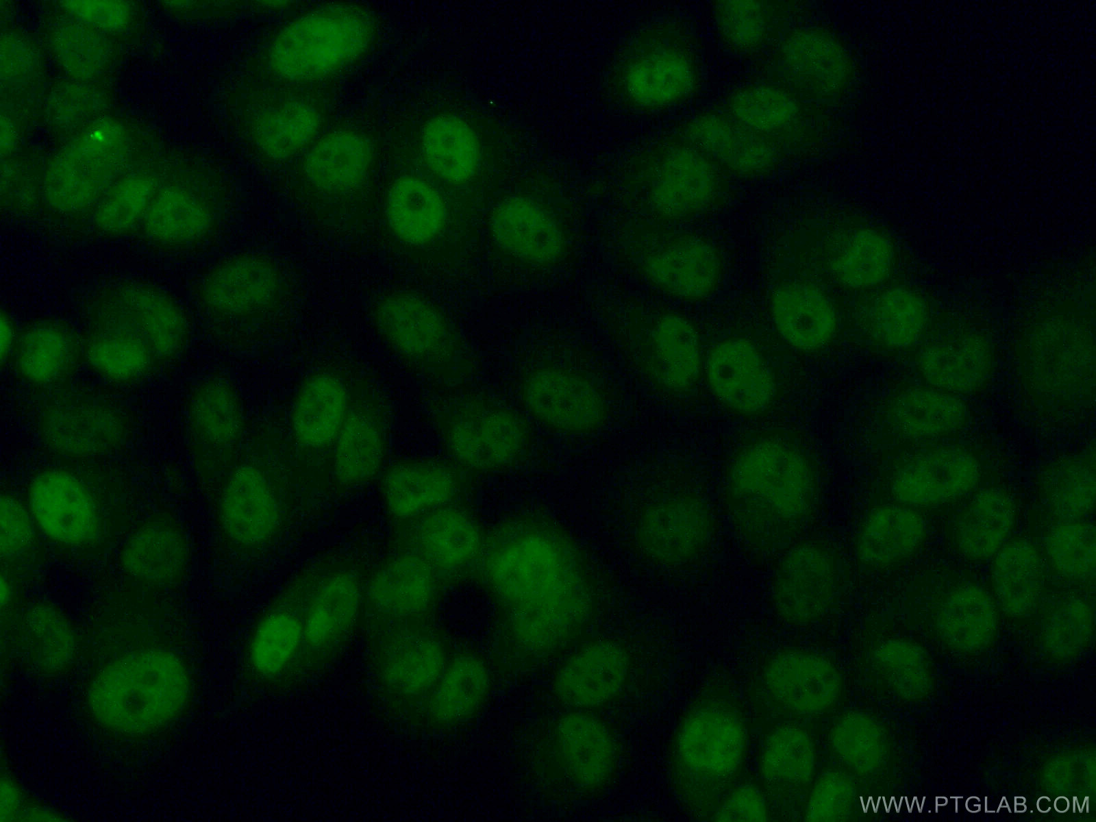 SOX2 antibody (11064-1-AP) | Proteintech | 武汉三鹰生物技术有限公司