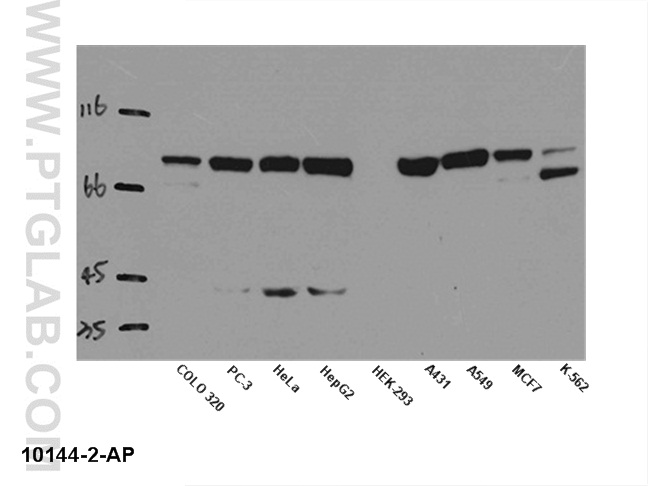 STAT1 antibody (10144-2-AP) | Proteintech | 武汉三鹰生物技术有限公司