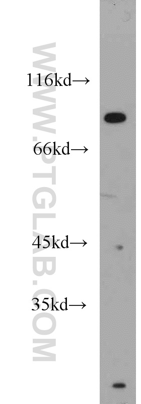 STAT1 Antibody 10144-2-AP | Proteintech