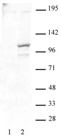 STAT2 phospho Tyr689 antibody (pAb) | Proteintech | 武汉三鹰生物技术有限公司