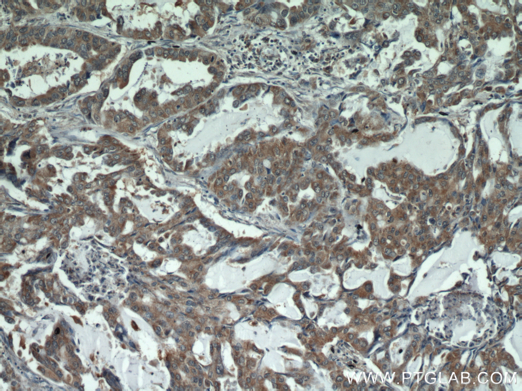 STAT3 antibody (51076-2-AP) | Proteintech | 武汉三鹰生物技术有限公司