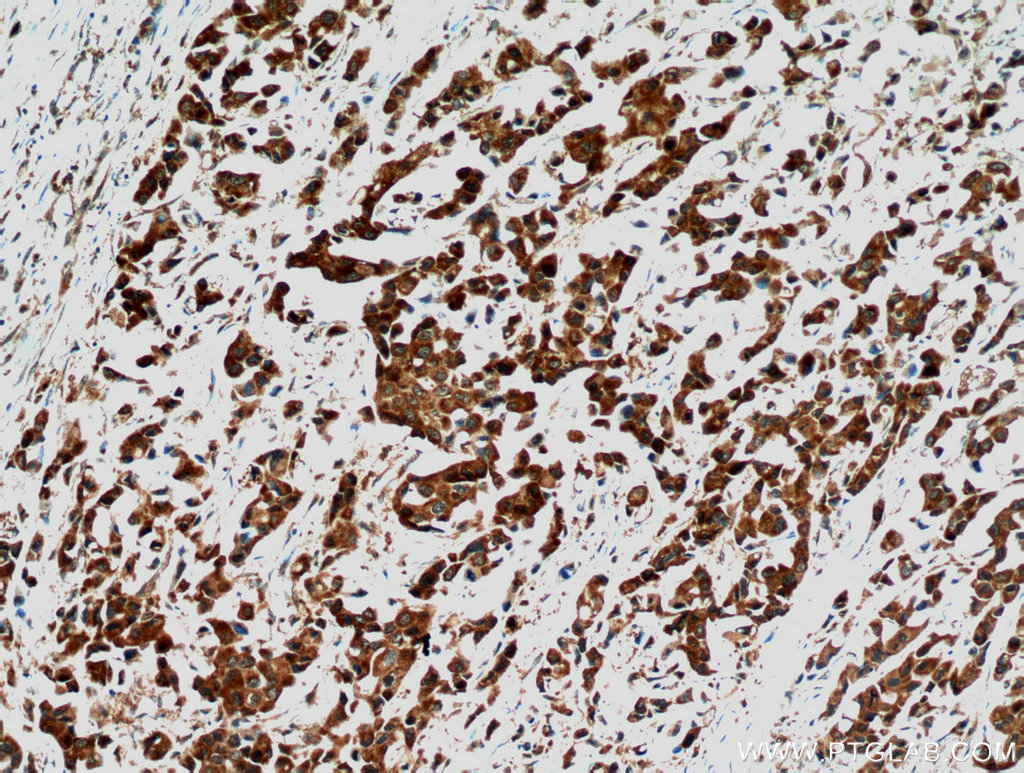 STAT3 antibody (51076-2-AP) | Proteintech | 武汉三鹰生物技术有限公司