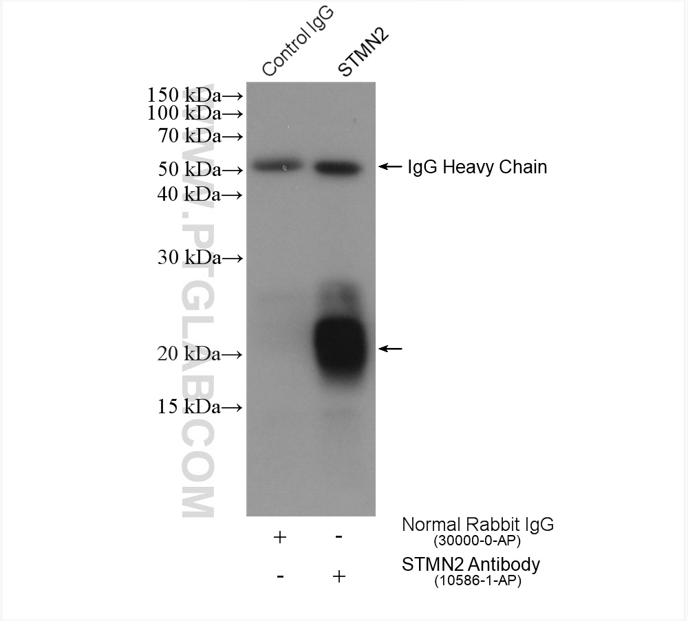 STMN2 antibody (10586-1-AP) | Proteintech | 武汉三鹰生物技术有限公司