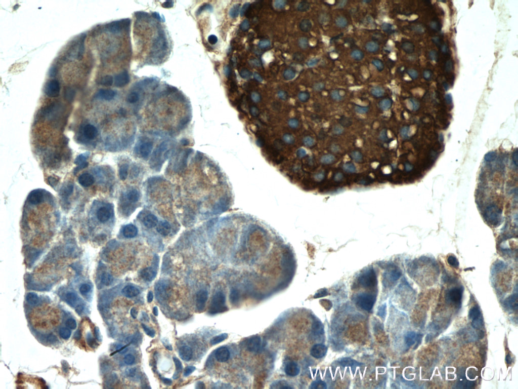 Synaptophysin Antibody 17785-1-AP | Proteintech