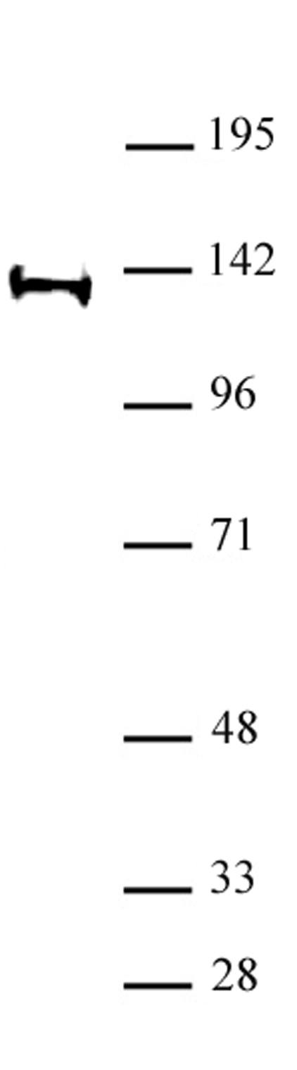 Supt16H / Spt16 antibody (pAb) | Proteintech | 武汉三鹰生物技术有限公司