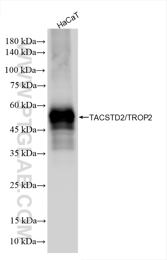 TACSTD2/TROP2 antibody (86155-1-RR) | Proteintech | 武汉三鹰生物技术有限公司