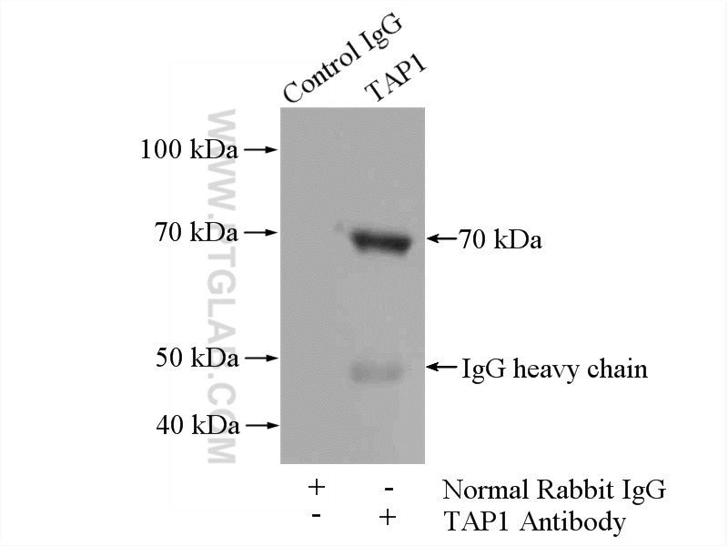 TAP1 antibody (11114-1-AP) | Proteintech | 武汉三鹰生物技术有限公司