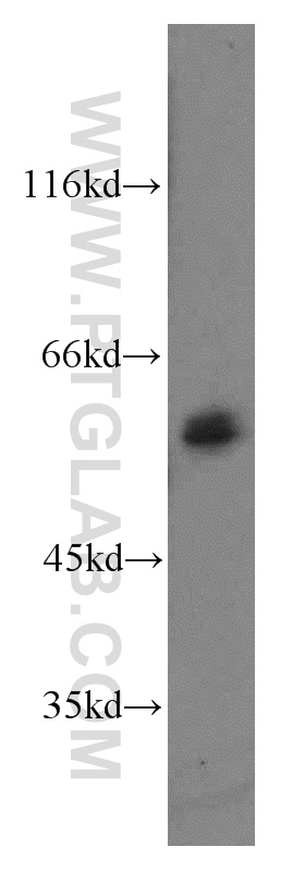 TBX21,T-bet Antibody 13700-1-AP | Proteintech