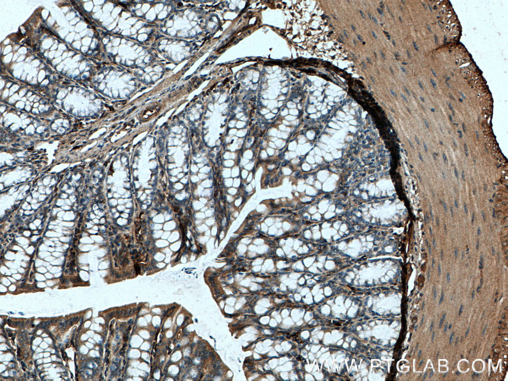 TFAM Antibody 22586-1-AP | Proteintech
