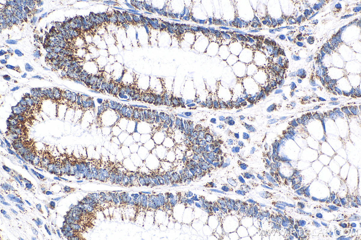 TFAM antibody (22586-1-AP) | Proteintech | 武汉三鹰生物技术有限公司