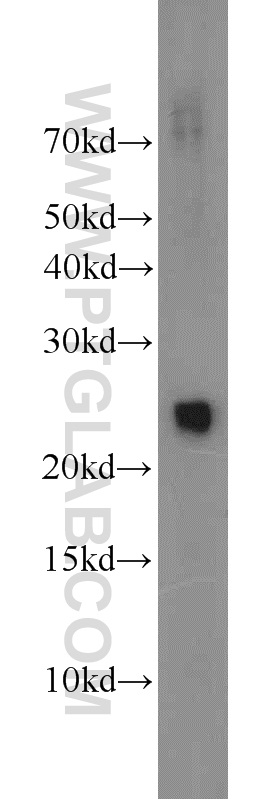 TFAM Antibody 23996-1-AP | Proteintech