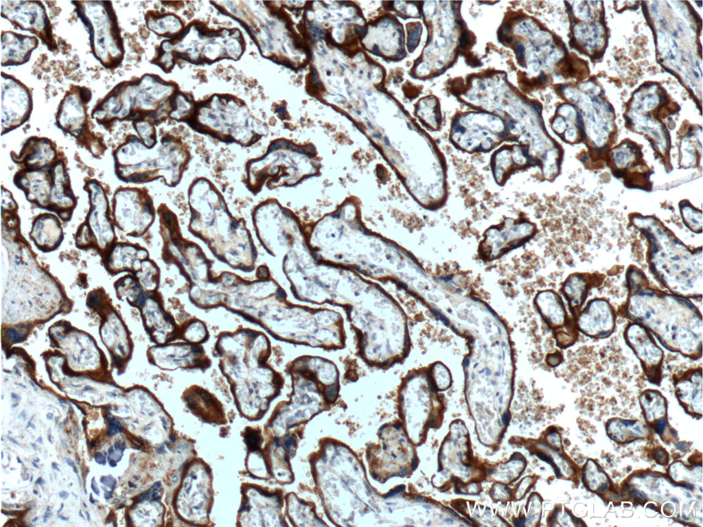 CD71 antibody (10084-2-AP) | Proteintech