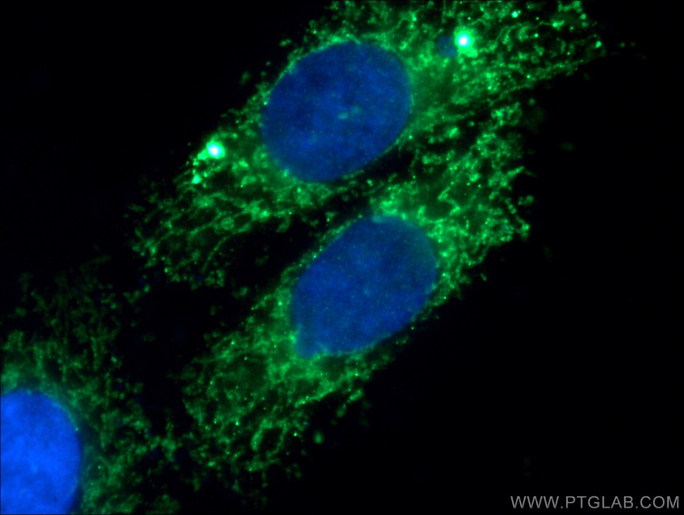 Tim23 Antibody 11123-1-AP | Proteintech