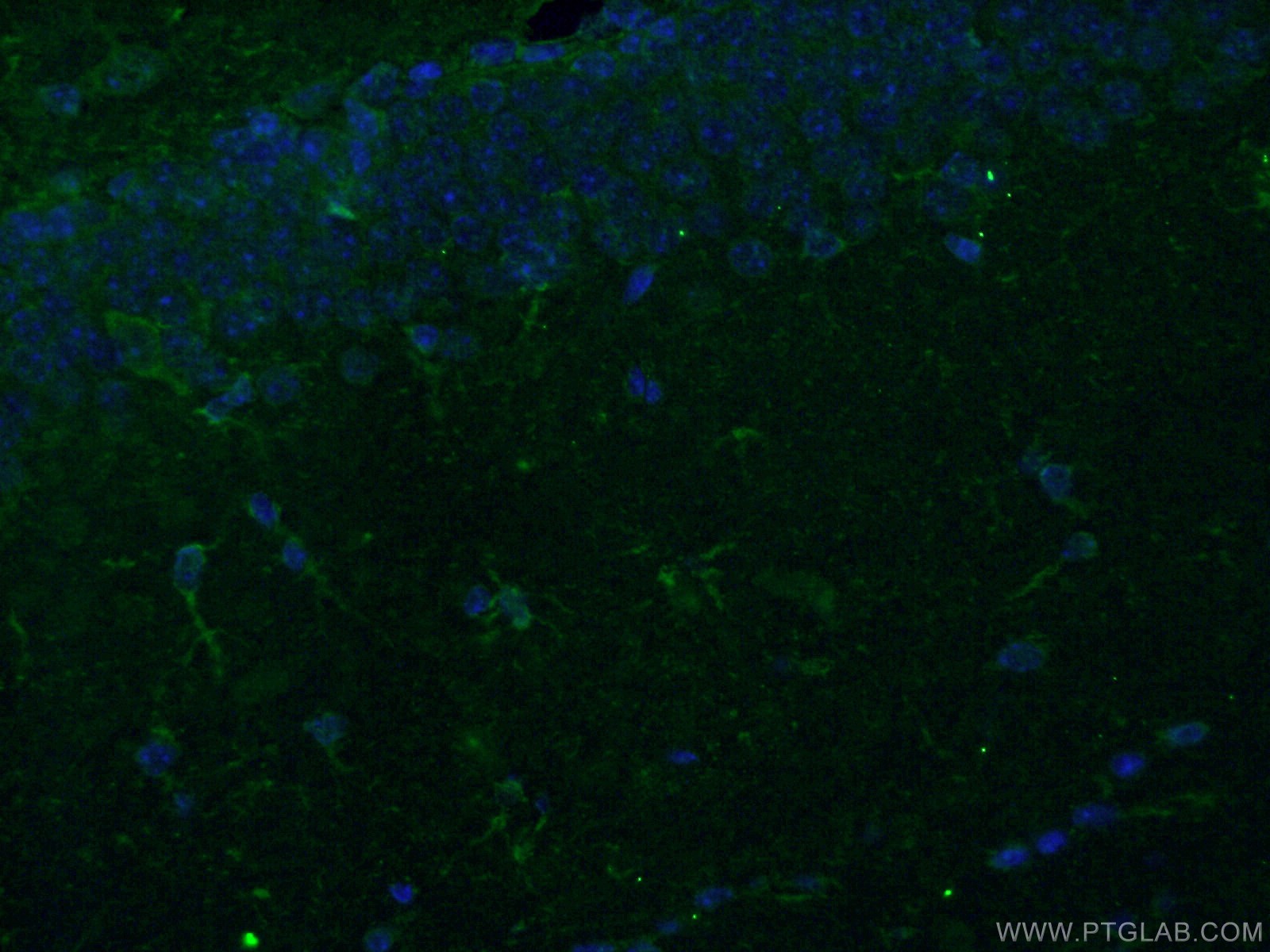 TMEM119 antibody (27585-1-AP) | Proteintech