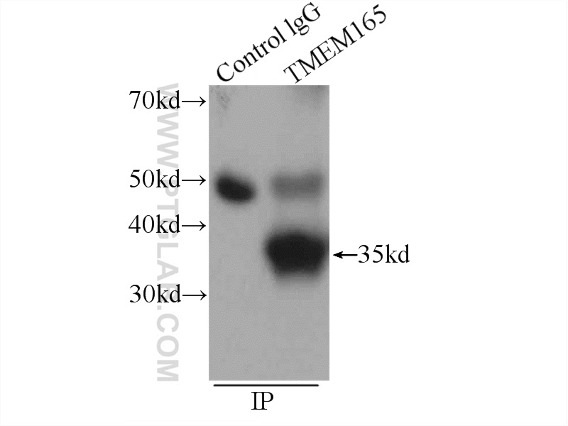 TMEM165 antibody (20485-1-AP) | Proteintech | 武汉三鹰生物技术有限公司