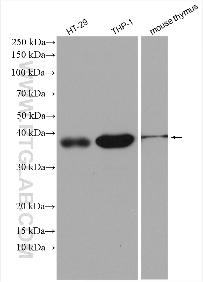 TMEM173/STING antibody (19851-1-AP) | Proteintech | 武汉三鹰生物技术有限公司