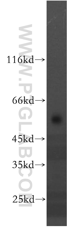 TMEM175 Antibody 19925-1-AP | Proteintech