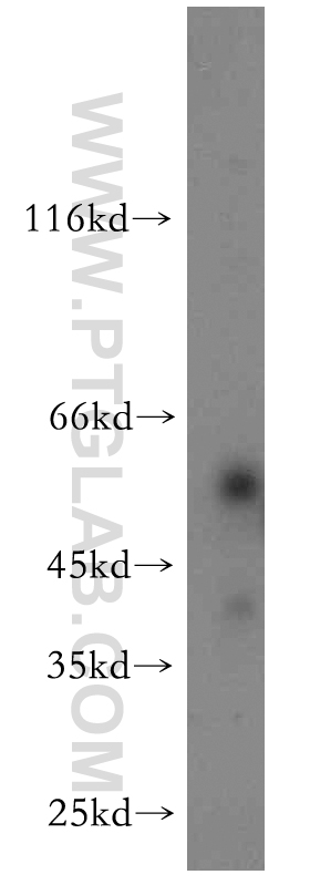 TMEM175 Antibody 19925-1-AP | Proteintech