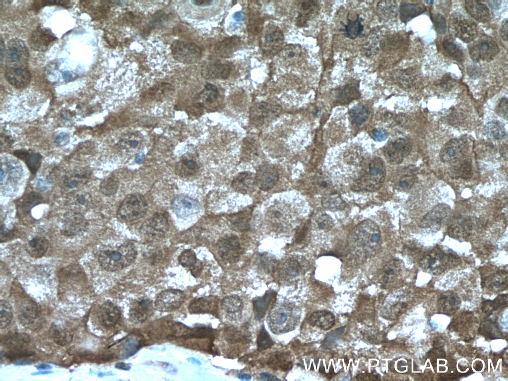 ASC/TMS1 Antibody 10500-1-AP | Proteintech