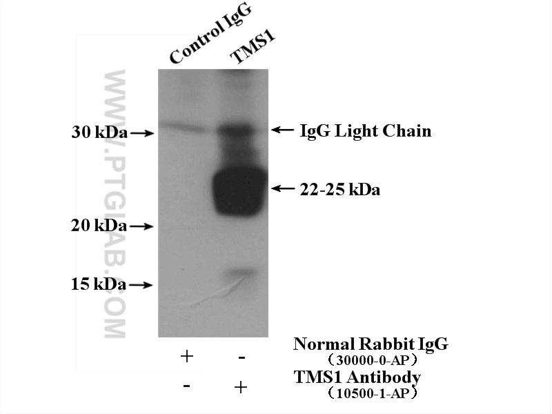 ASC/TMS1 antibody (10500-1-AP) | Proteintech | 武汉三鹰生物技术有限公司
