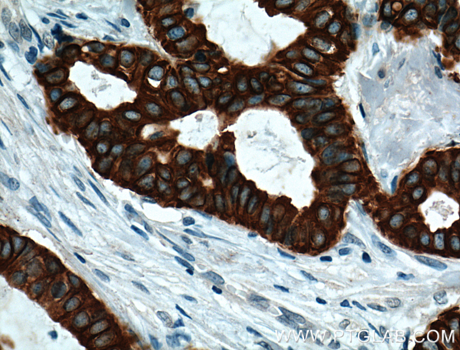 TNF Alpha Antibody 60291-1-Ig | Proteintech