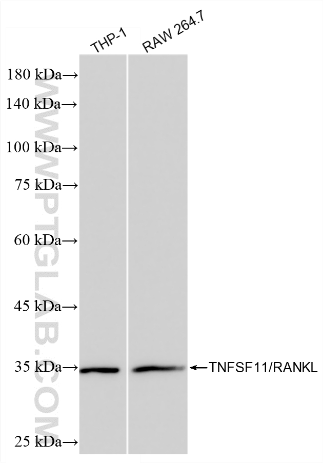 TNFSF11/RANKL antibody (85321-2-RR) | Proteintech | 武汉三鹰生物技术有限公司