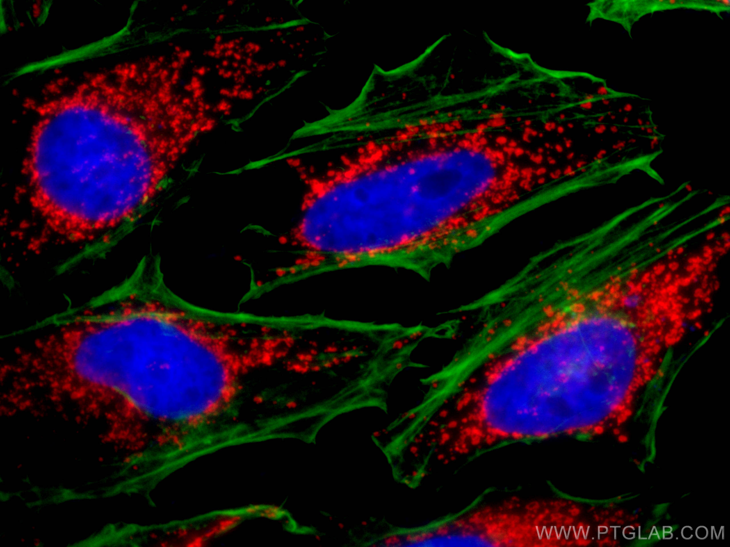 TOM20 Fusion Protein Ag2378 | Proteintech | 武汉三鹰生物技术有限公司