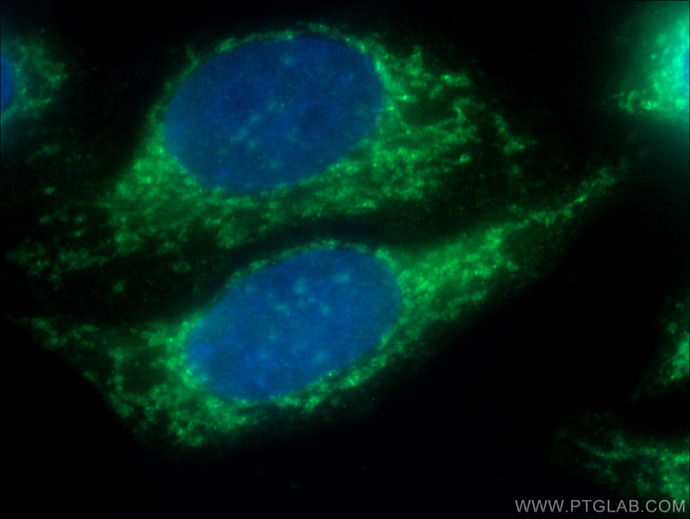 TOMM22 Antibody 66562-1-Ig | Proteintech