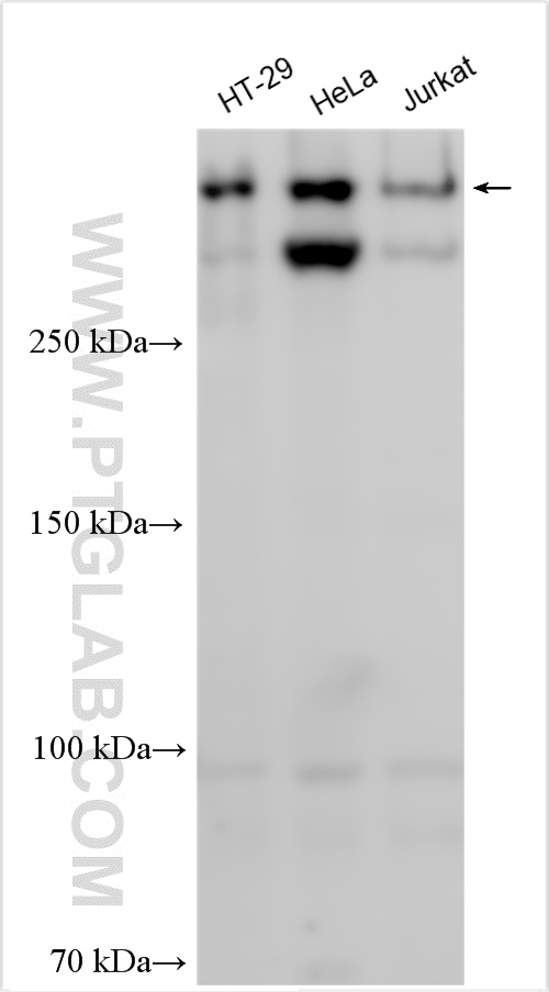 TP53BP1-Specific antibody (20002-1-AP) | Proteintech | 武汉三鹰生物技术有限公司