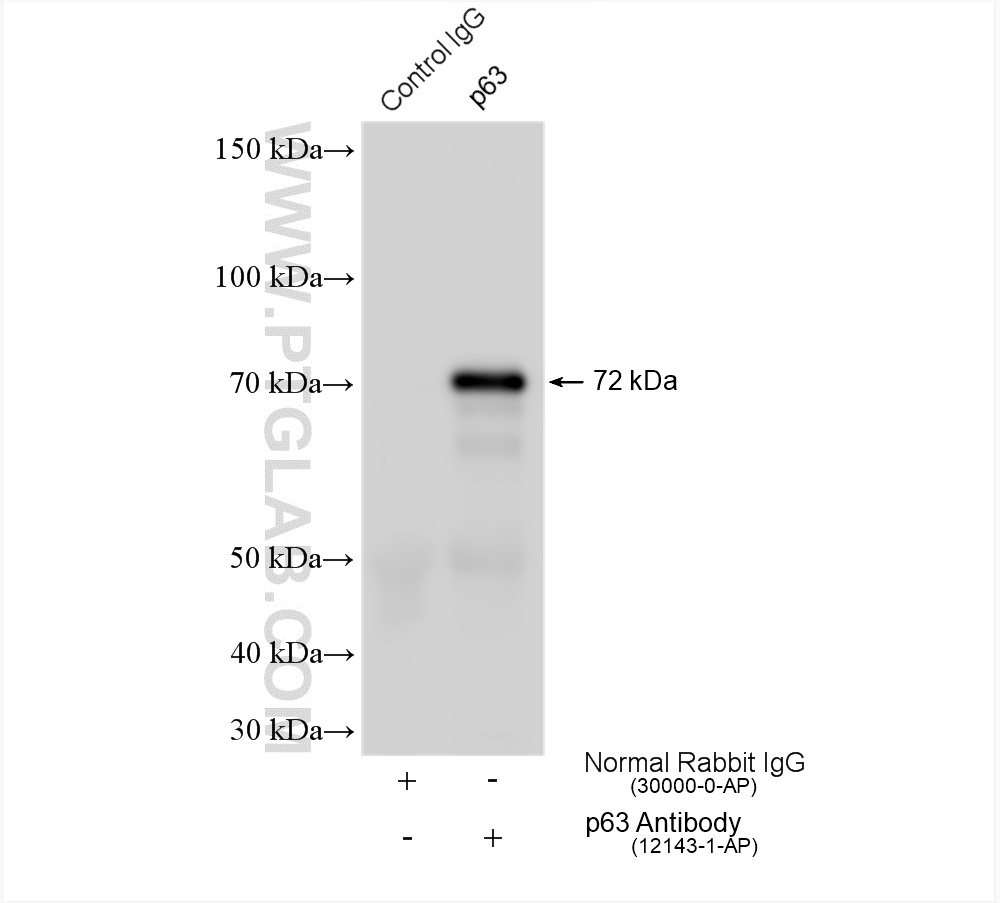 p63 antibody (12143-1-AP) | Proteintech | 武汉三鹰生物技术有限公司