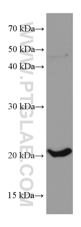 Tim23 antibody (67535-1-Ig) | Proteintech