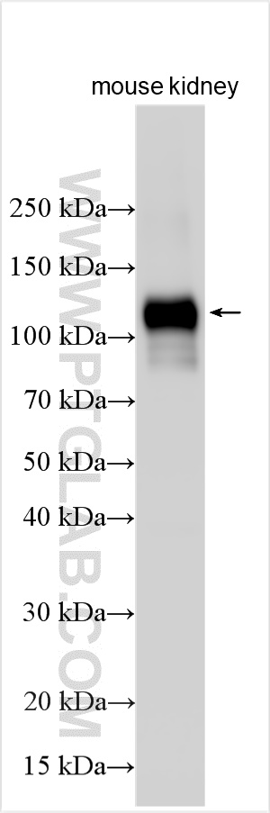 Uromodulin antibody (32657-1-AP) | Proteintech | 武汉三鹰生物技术有限公司