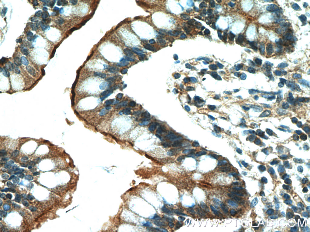 Villin Antibody 16488-1-AP | Proteintech
