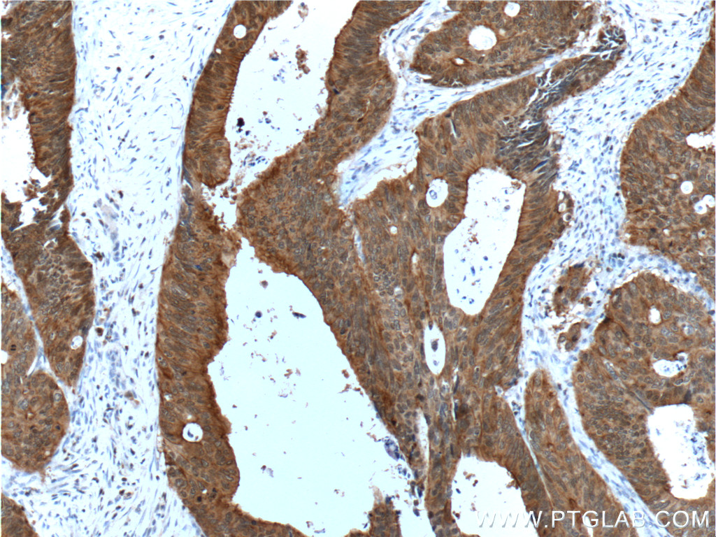 Villin antibody (66096-1-Ig) | Proteintech | 武汉三鹰生物技术有限公司