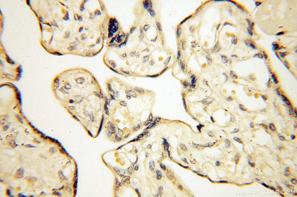 VPS33B antibody (12195-1-AP) | Proteintech | 武汉三鹰生物技术有限公司