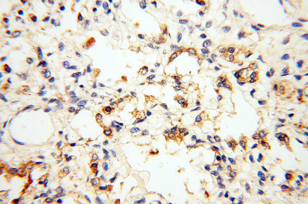 VPS33B antibody (12195-1-AP) | Proteintech | 武汉三鹰生物技术有限公司