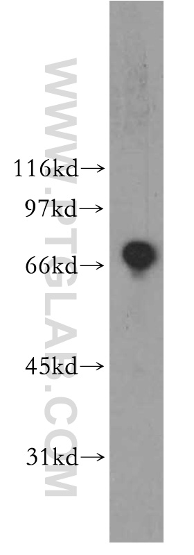 ZBP1 antibody (13285-1-AP) | Proteintech | 武汉三鹰生物技术有限公司