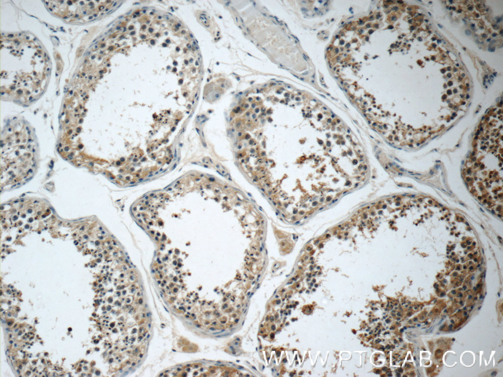 ZDHHC13 antibody (24759-1-AP) | Proteintech | 武汉三鹰生物技术有限公司