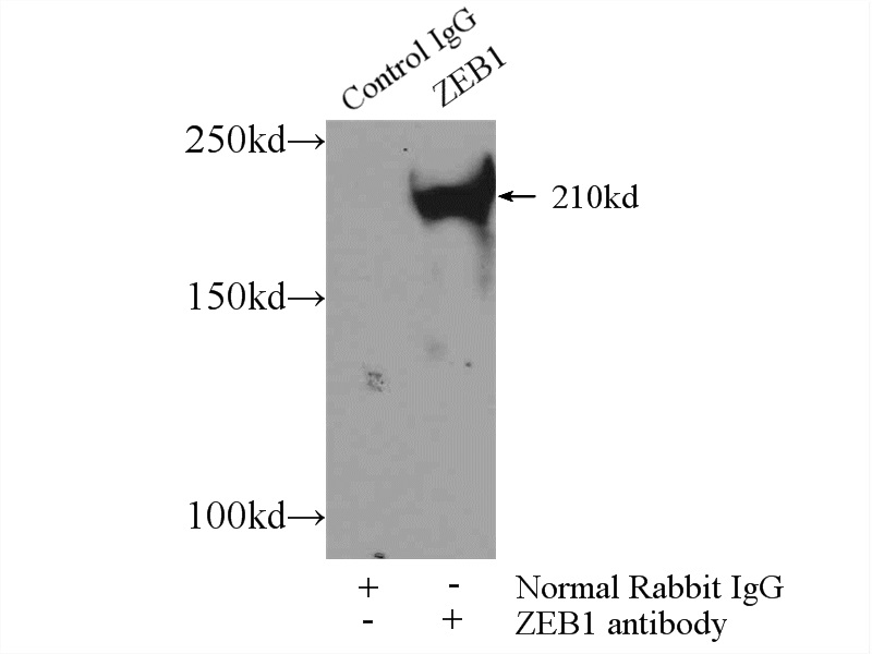 ZEB1 Antibody 21544-1-AP | Proteintech