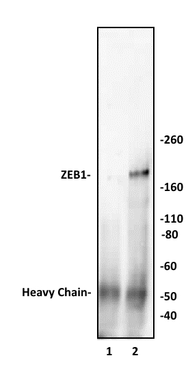 Results for "ZEB1" | Proteintech Group | 武汉三鹰生物技术有限公司