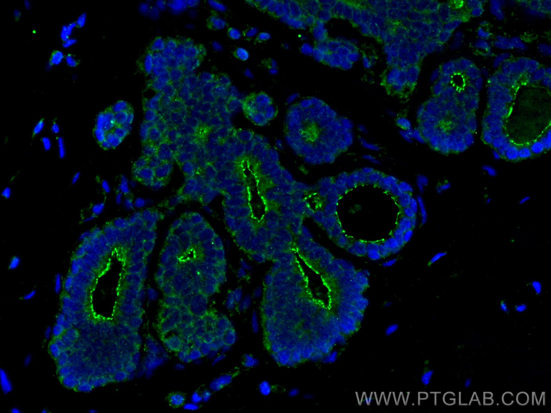 ZO-1 antibody (21773-1-AP) | Proteintech | 武汉三鹰生物技术有限公司